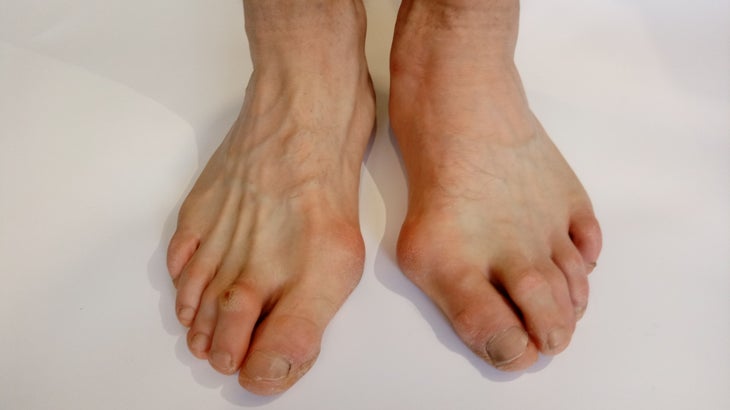 Re-Gram: Show Us Your #ClimberFeet